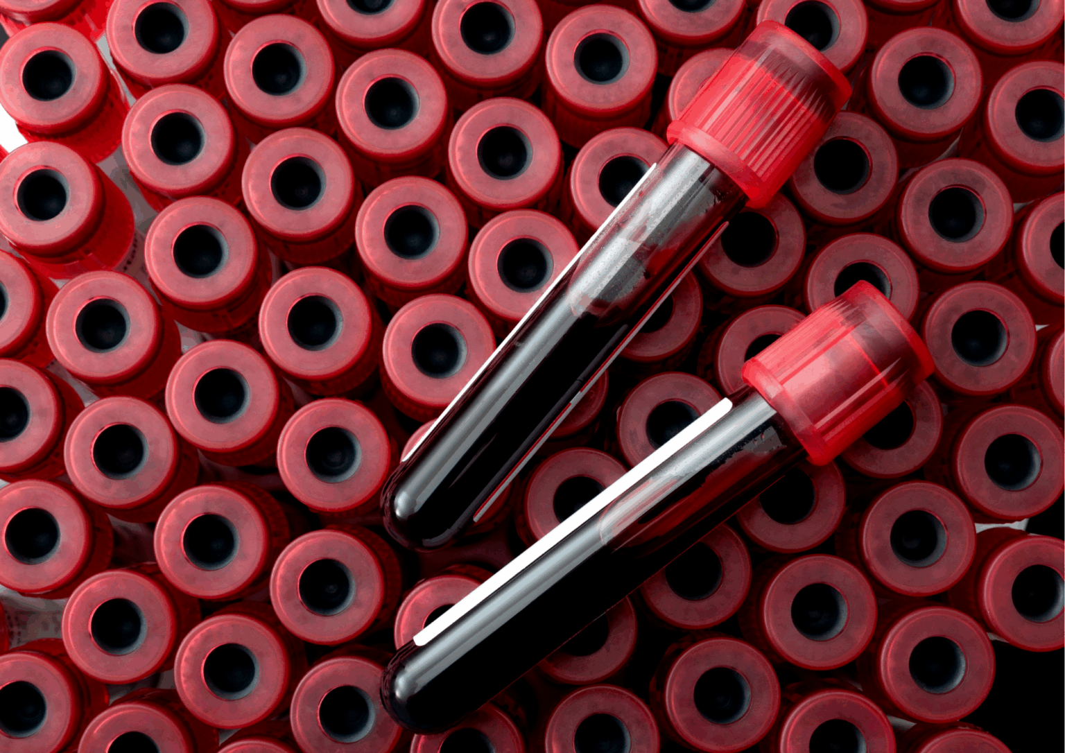 Hormone Blood Tests Online | MediTests Australia