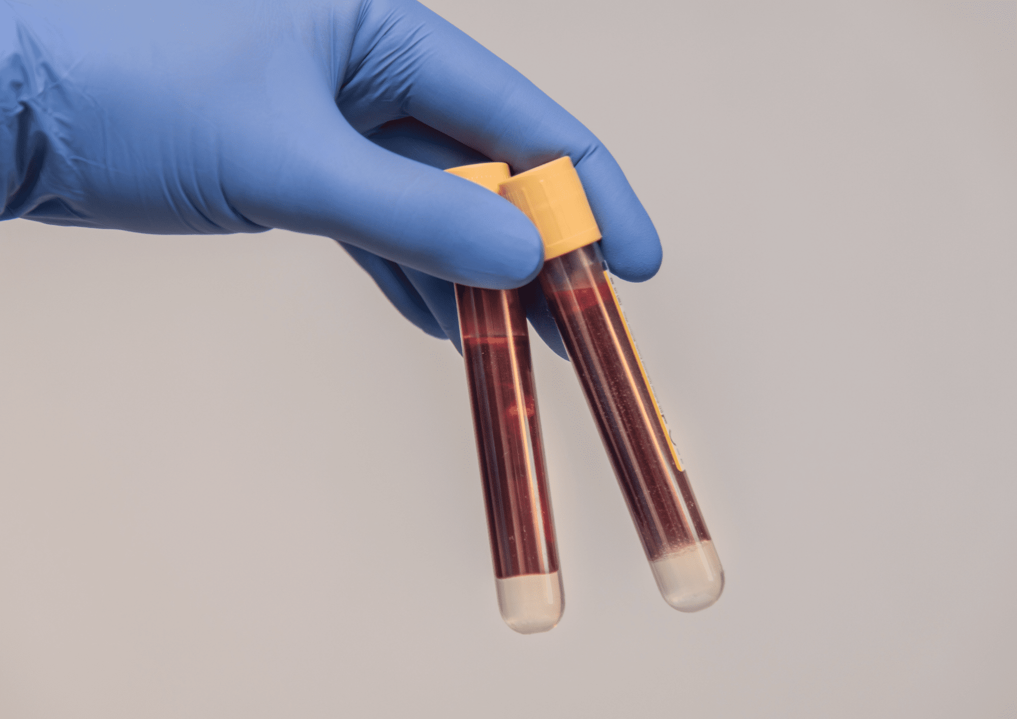 Hormone Blood Tests Online | MediTests Australia